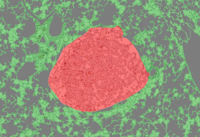 IHC Lung Cancer Mouse